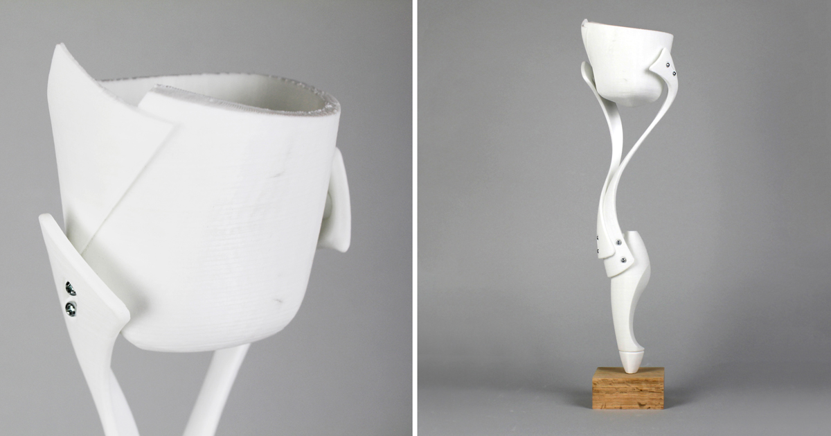 student develops prosthesis that helps ballerinas perfect technique