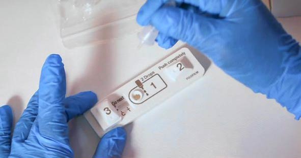 rapid diagnostic kit for tuberculosis wins GOOD DESIGN grand award