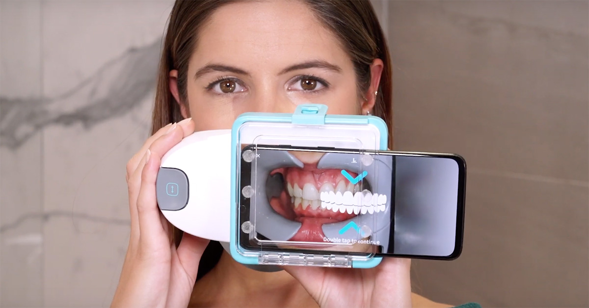 scanbox, the dental scanner that sends images of your teeth to your dentist