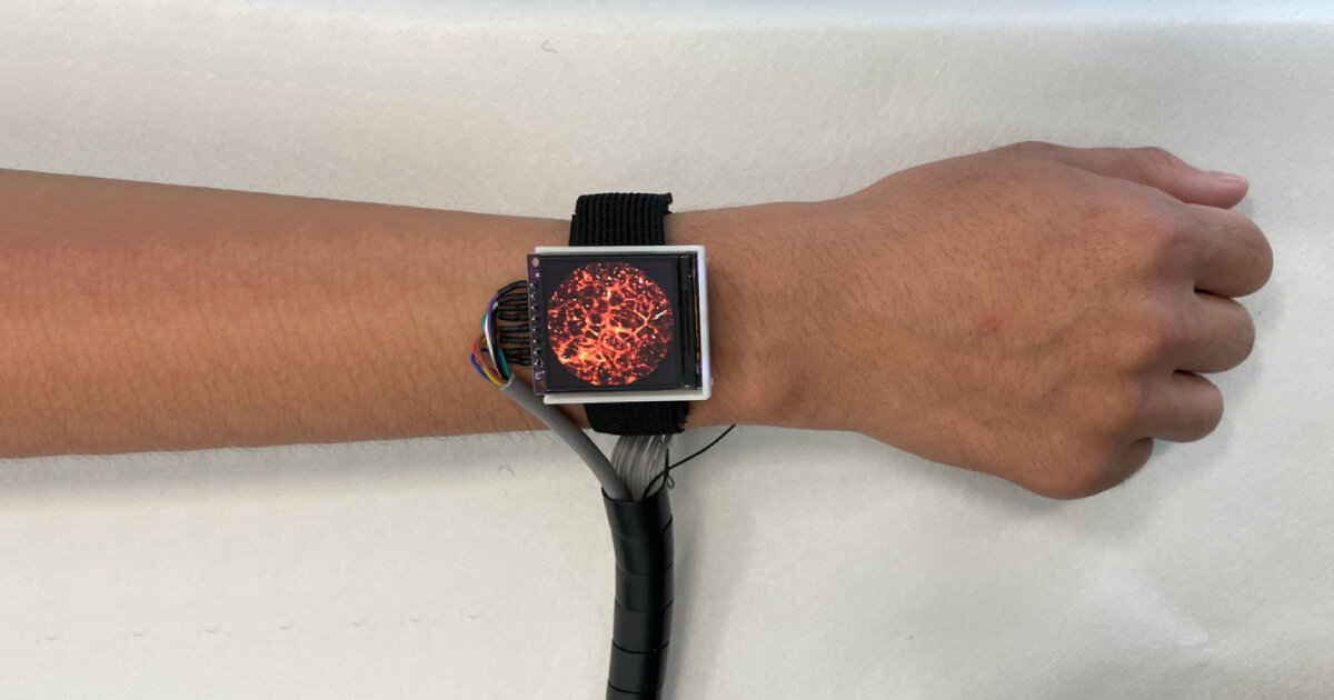 high tech watch takes photos of blood vessels real-time to monitor ...