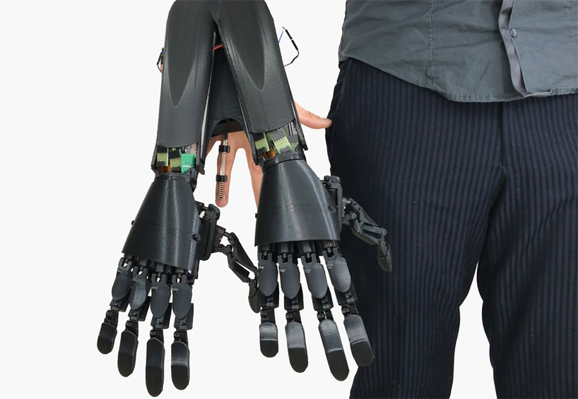 youbionic's 3D printed double hand builds first augmented human