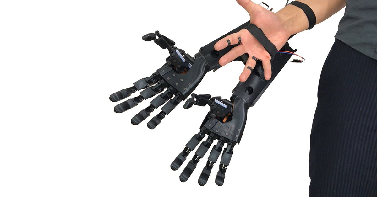 youbionic's 3D printed double hand builds first augmented human