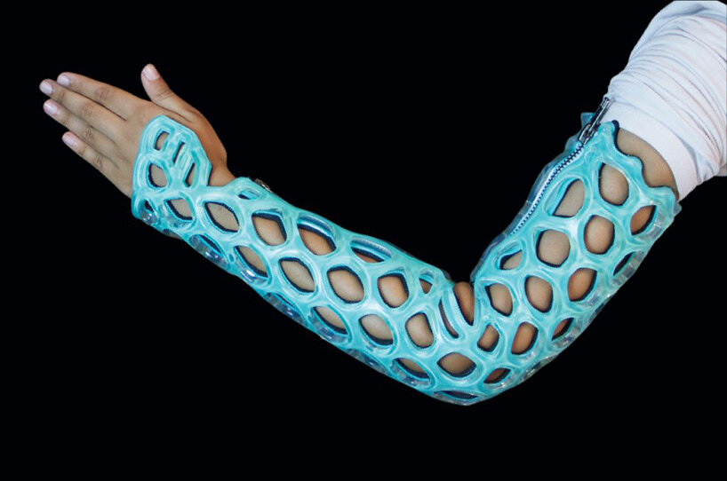 Orthopedic Body Cast